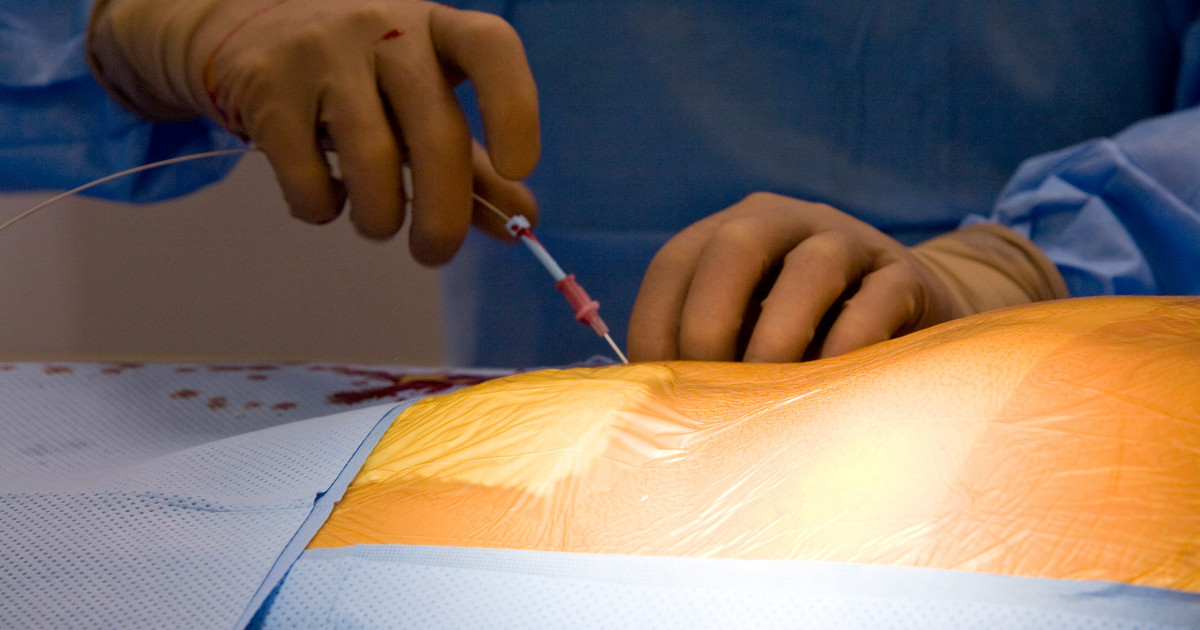 Minimally-invasive aortic valve replacement surgery - Immanuel ...